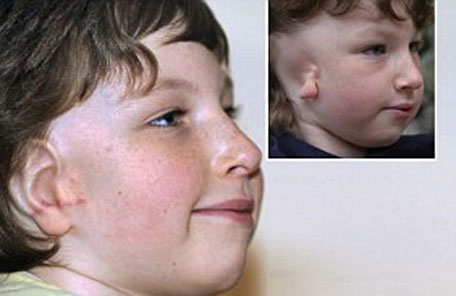 Best of Web: Docs fix boy born with no ear... - Offbeat - Emirates24|7