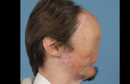 Amazing video of man with no face - Videos - Emirates24|7