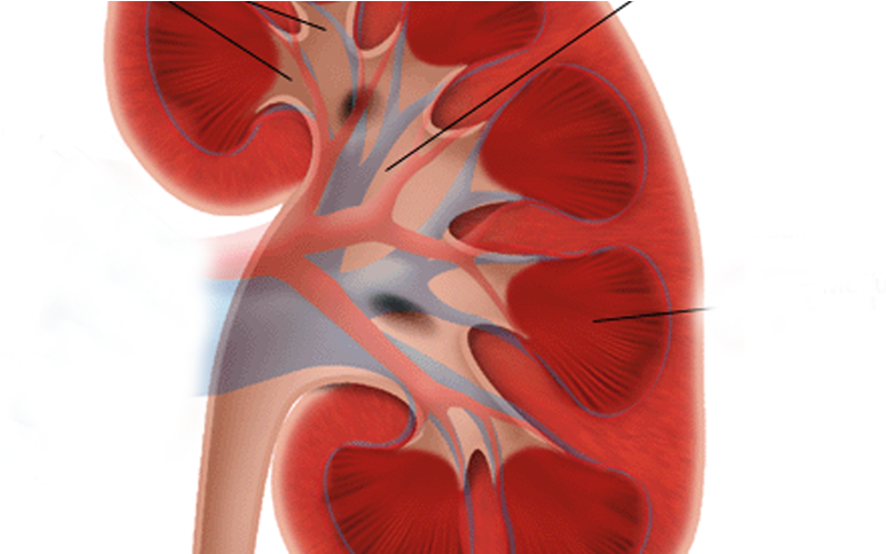 Hospital accused of stealing patient's kidney - News - Emirates24|7