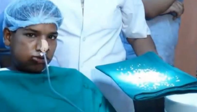 232 teeth extracted from boy's mouth - Offbeat - Crazy World - Emirates24|7
