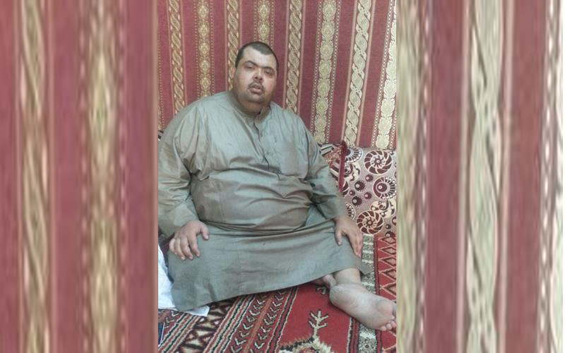 360-kg Saudi appeals for help - News - Region - Emirates24|7